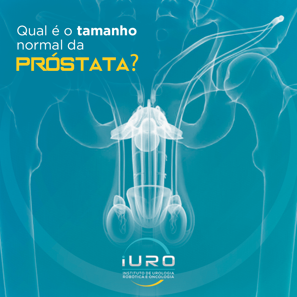 Qual é o tamanho normal da próstata? – iURO