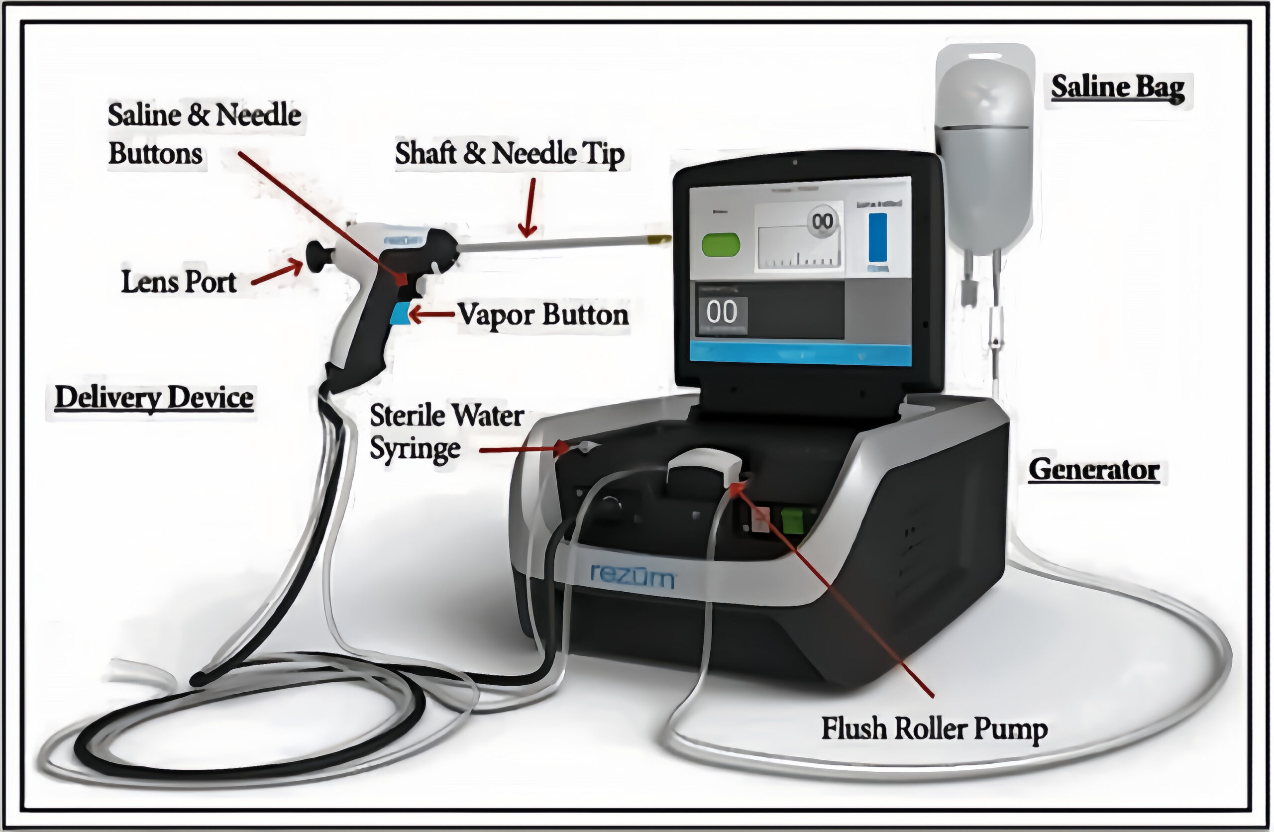 Tecnologia Rezum – iURO